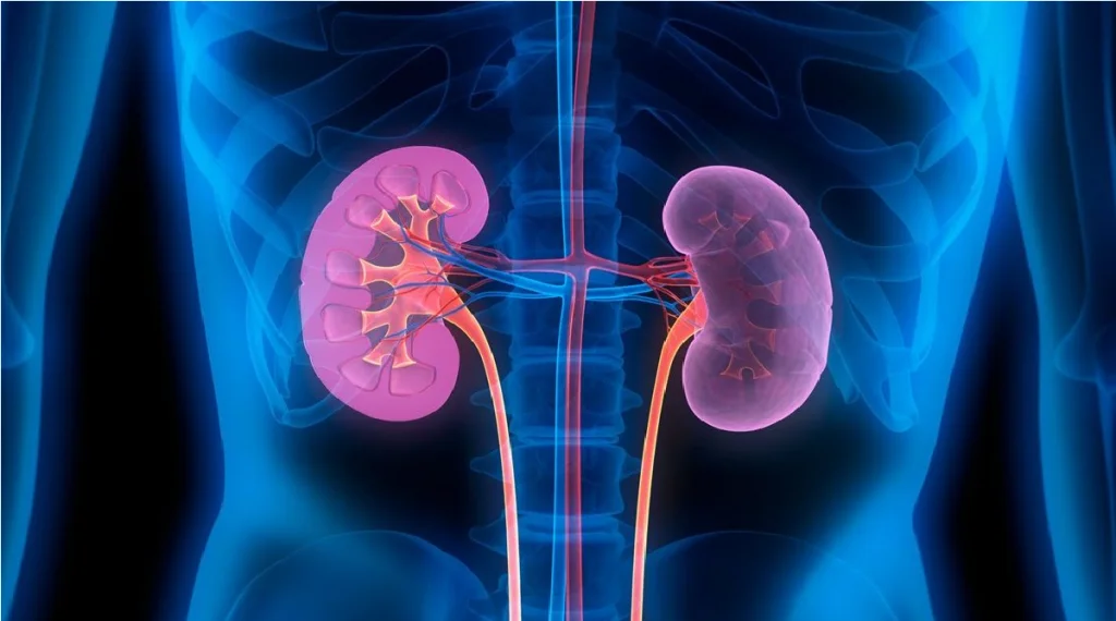 Anatomía De Los Cálculos Renales Litiasis Renal: Qué Es, Causas,
